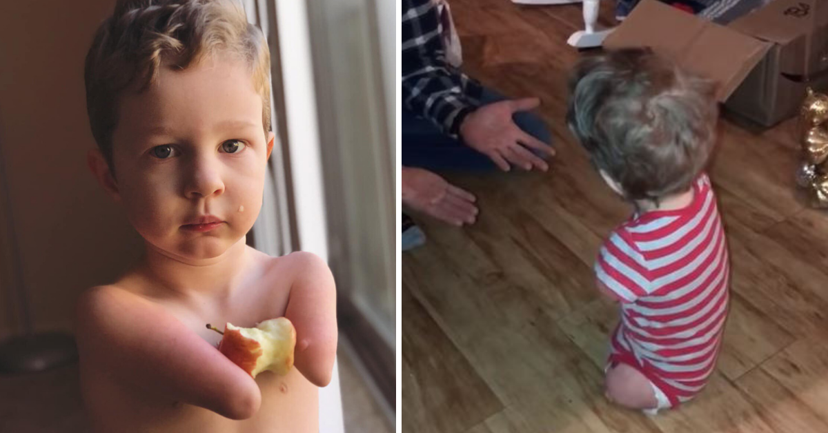 Watch The Heartwarming Moment Boy Born With No Arms And Legs Takes ...